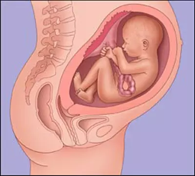 33ª semana de embarazo - Enfoque de parto