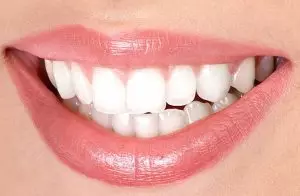 Dişlərinizi necə ağartmaq olar: Zərərsiz evdə dişlərinizi necə ağlamaq olar?