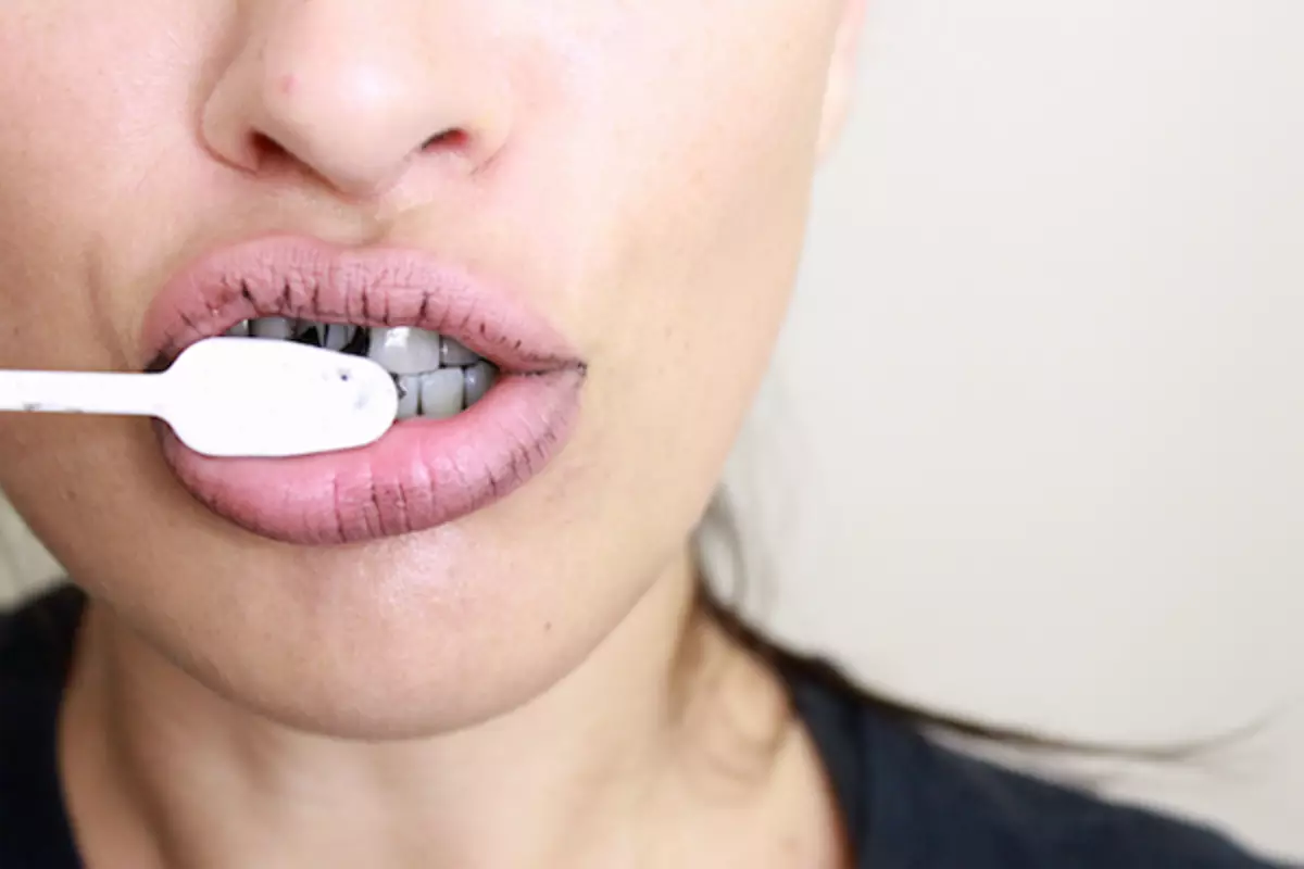 Πώς να λευκαίνουν τα δόντια σας: Πώς να λευκαίνουν τα δόντια σας στο σπίτι χωρίς βλάβη;