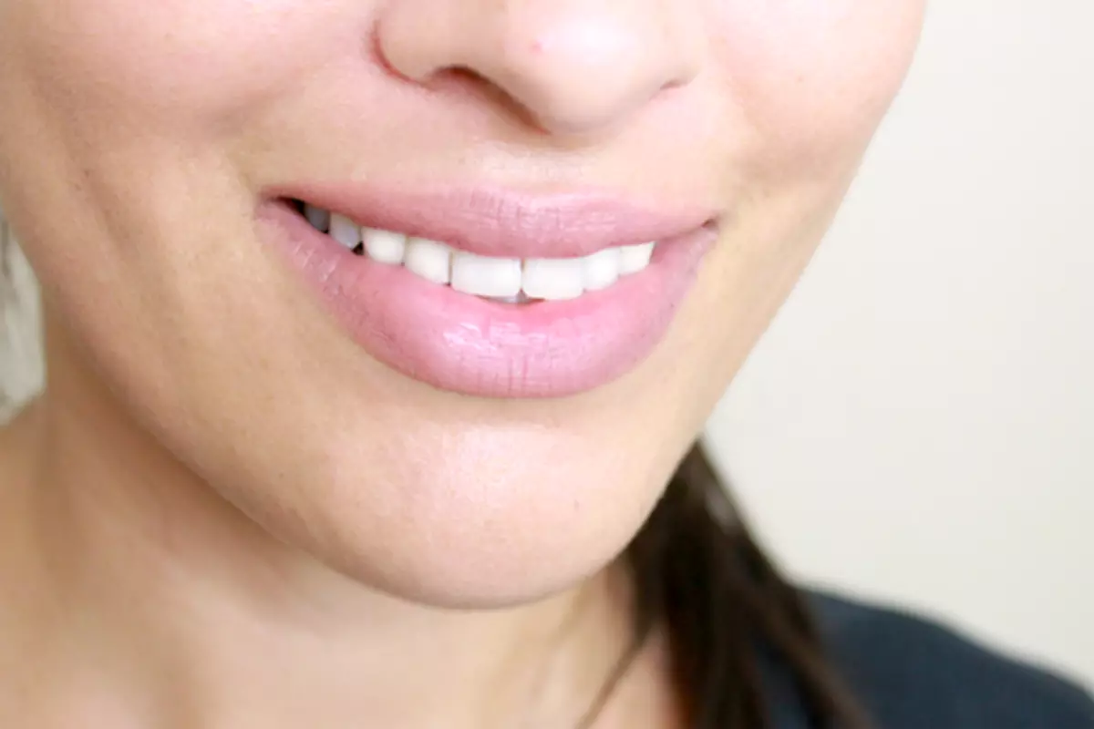 Hvordan bleknet tennene dine: Hvordan bleknet tennene dine hjemme uten skade?